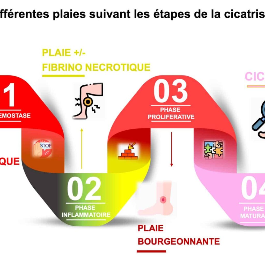 Quels sont les différents types de plaies et leur classification ...