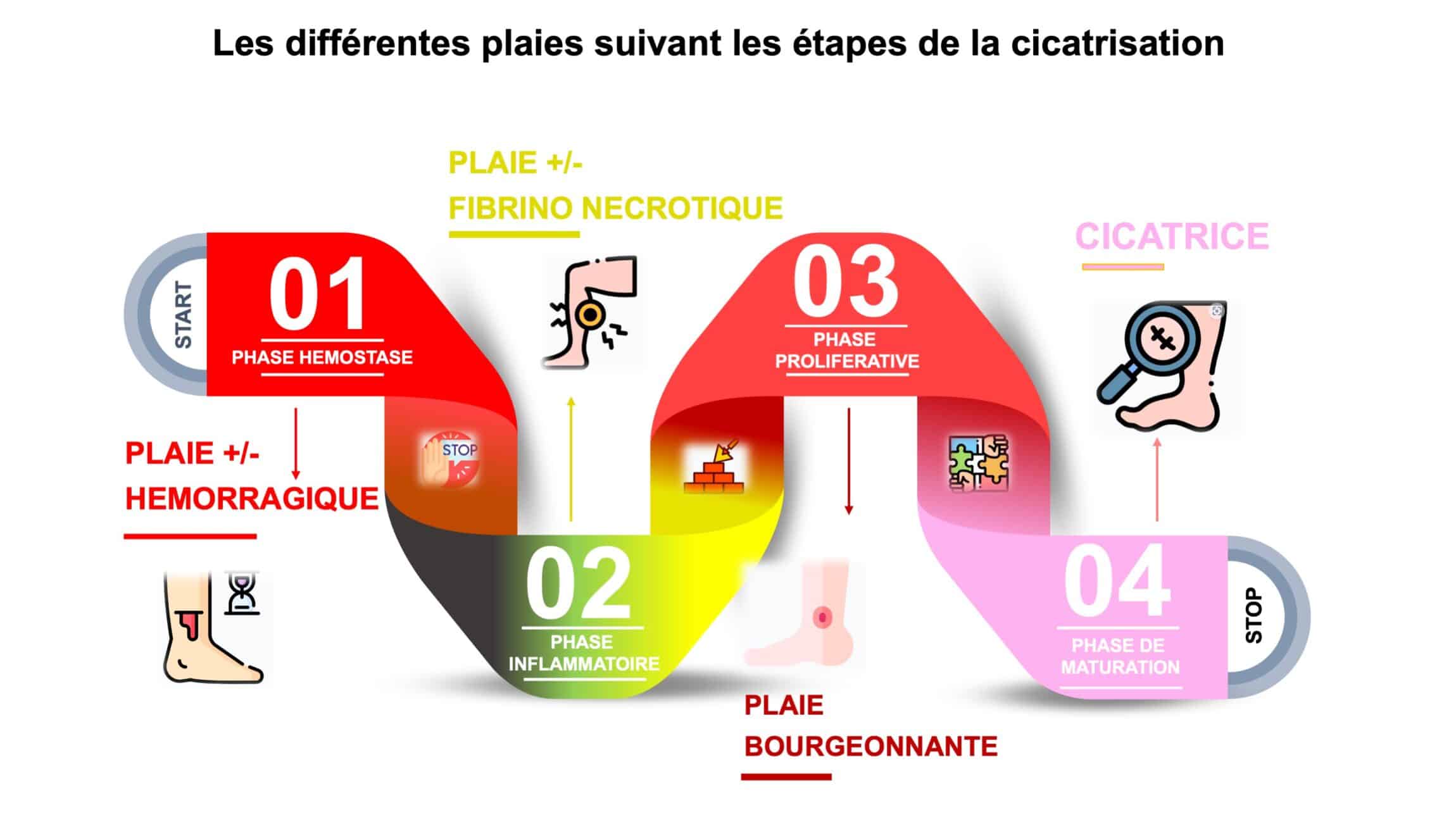 Quels sont les différents types de plaies et leur classification ? - Actusoins